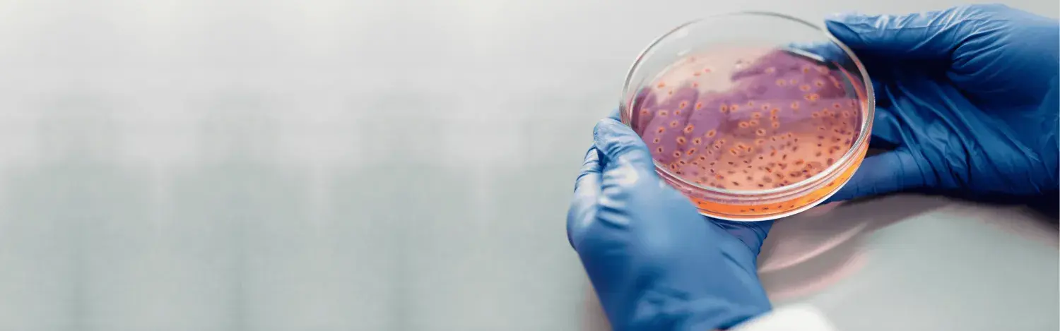 Contact Plate Tests in Hand Hygiene: Methods & Limits | CWS Hygiene